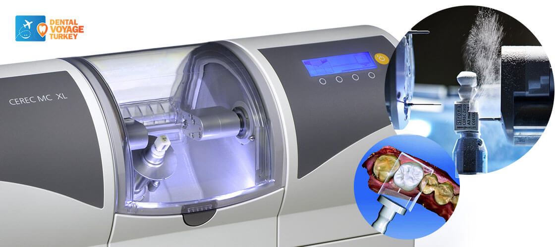 CAD/CAM – BaoHanhRang.Com.VN